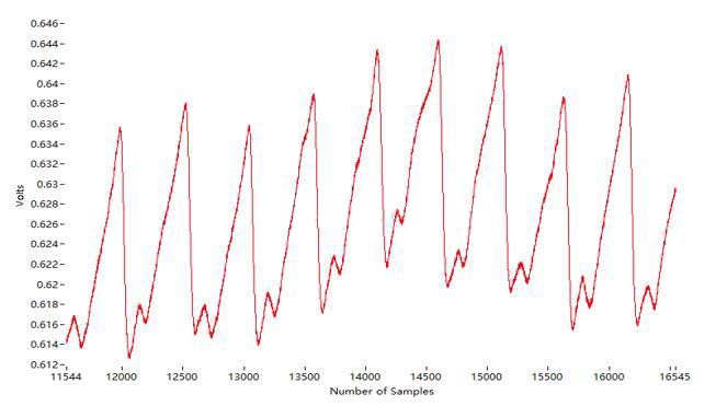 Optical heart rate measurement principle - Dyethin