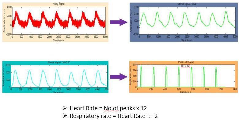 Optical heart rate measurement principle - Dyethin